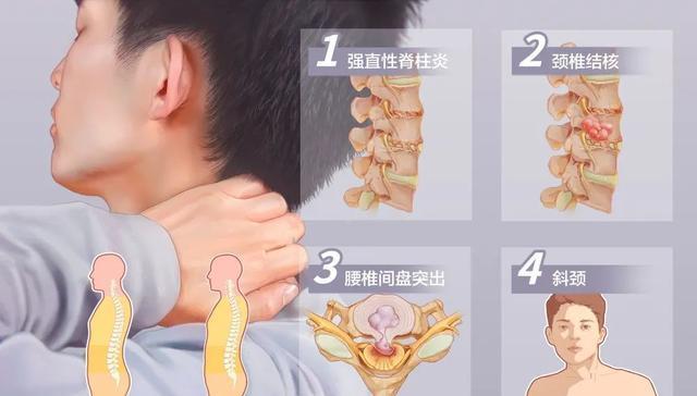 颈肩部疼痛原因有哪些？颈肩痛该怎么治疗？