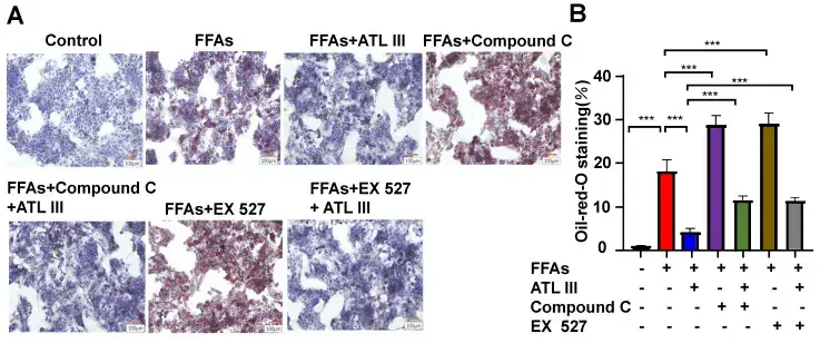 AbMole | Dorsomorphin (Compound C)：BMP/AMPK双通路抑制剂，为干细胞和肿瘤研究提供新视角