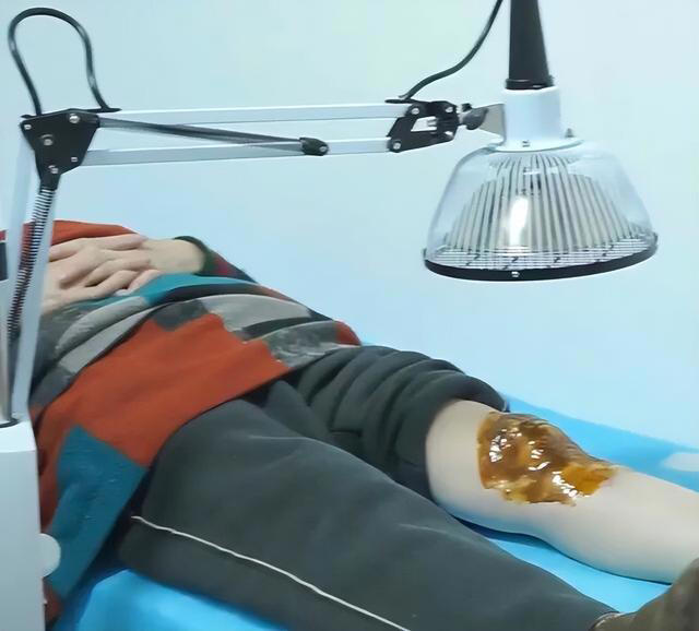 从社区义诊到系统康复：一场跨越五年疼痛的治愈之旅