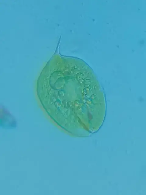 涡虫再生机制对医学有何启示?