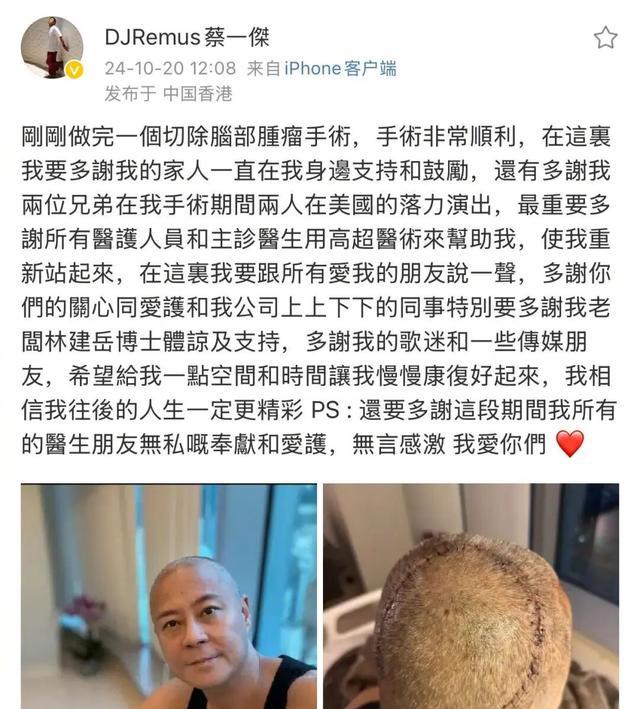 知名歌手在演唱会上自曝，脑癌已扩散，从72公斤瘦到63公斤，仍没有放弃
