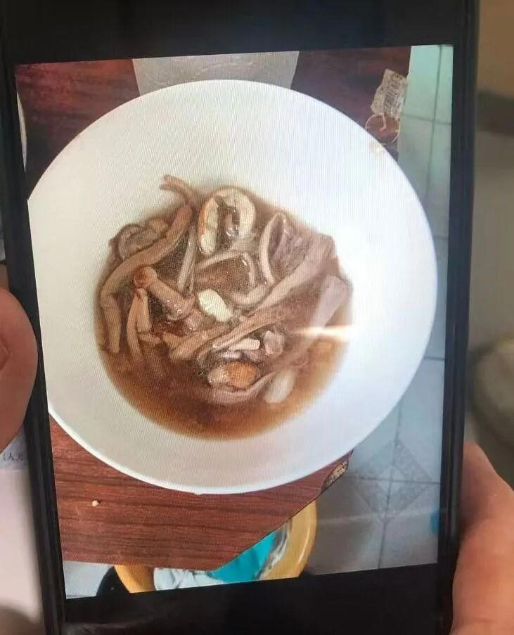 逛公园时千万要克制！六旬阿姨误食“ICU 菇”，治疗一周才出院